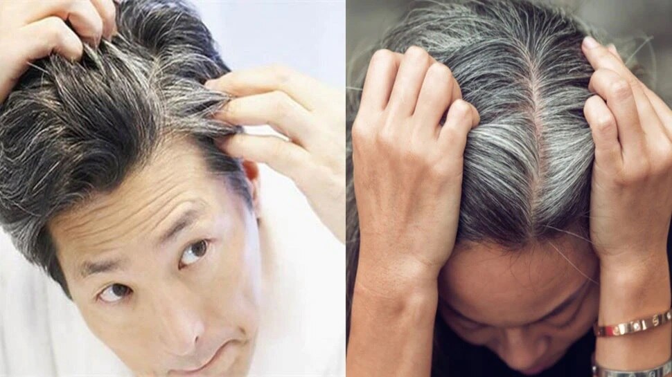 Columbia university study on white hair issue, how to blacken your hair ...