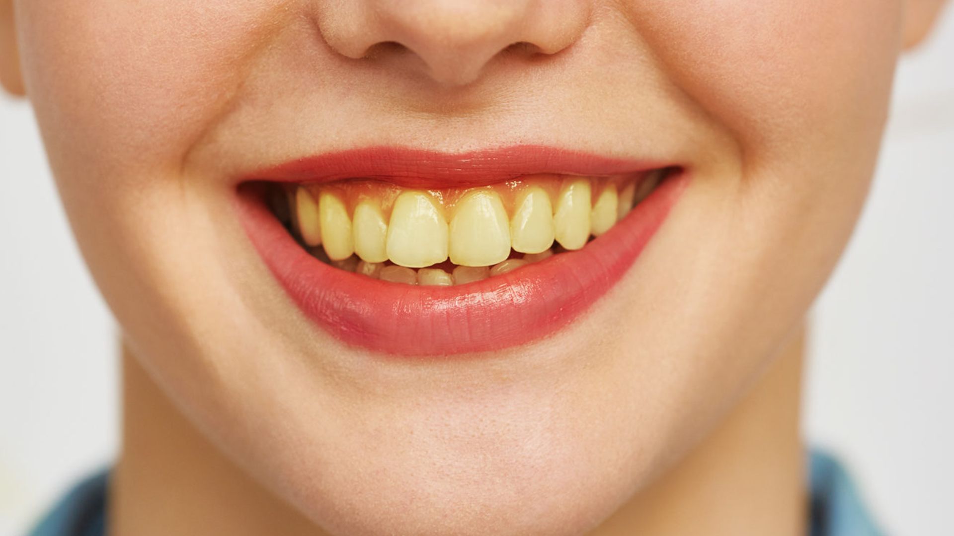 Remedy For Yellow Teeth: Get Rid Of Yellow Teeth Easily Like This Brush ...