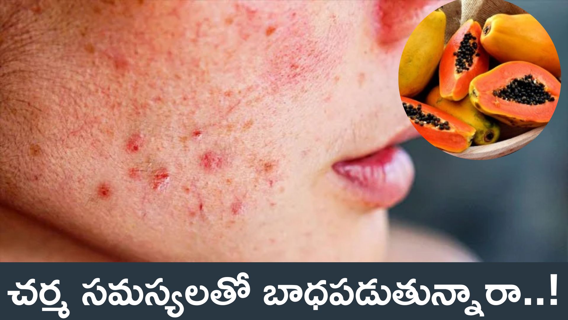 Rid Skin Problems In 2 Days: Get Rid Of Skin Problems In 2 Days With ...