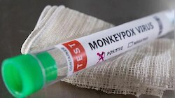 Indian company rolls out monkeypox test kit News in Telugu, Latest ...