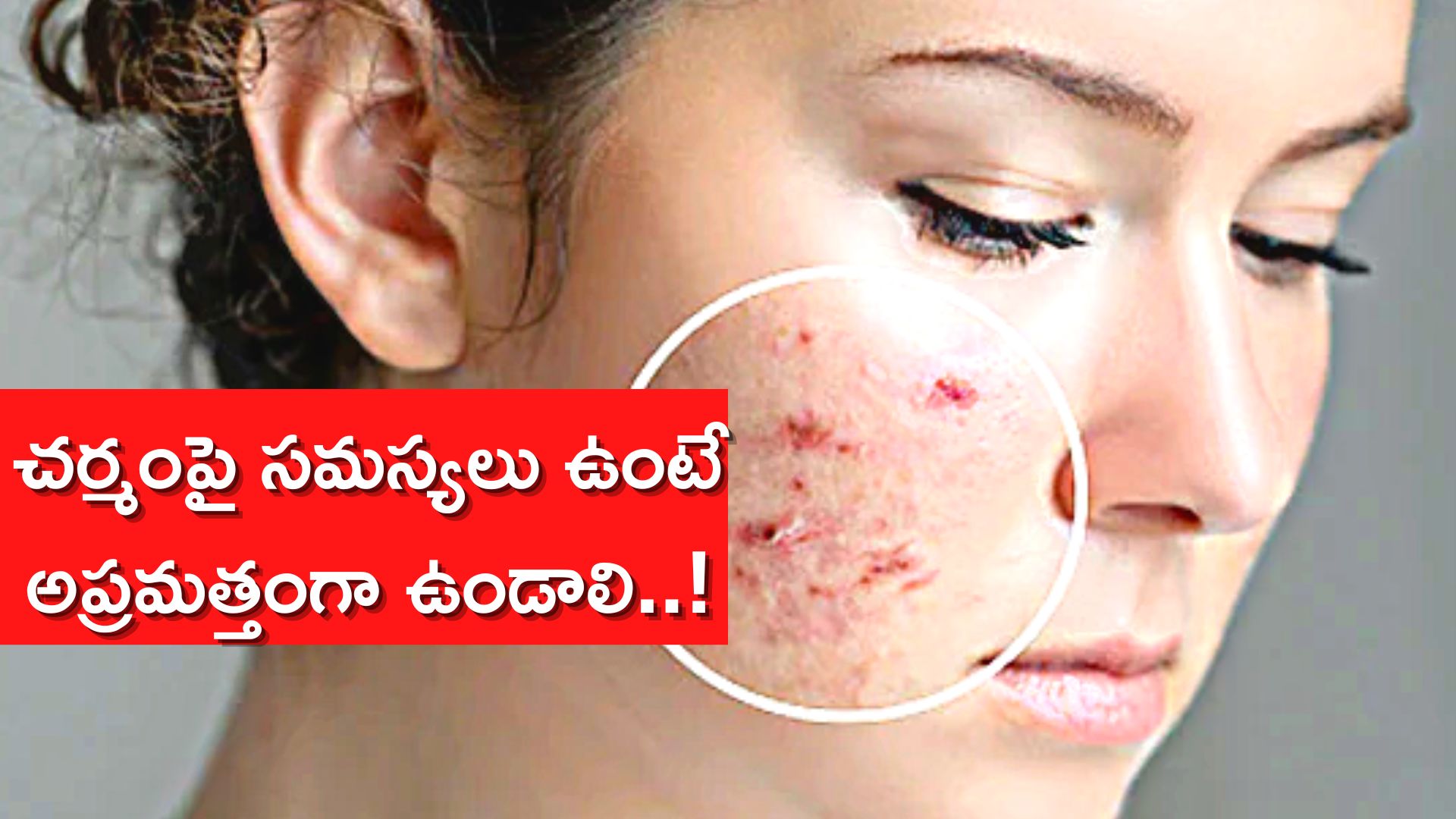 Cholesterol Control Tips In 15 Days: Itching And Pimples On Skin Should ...