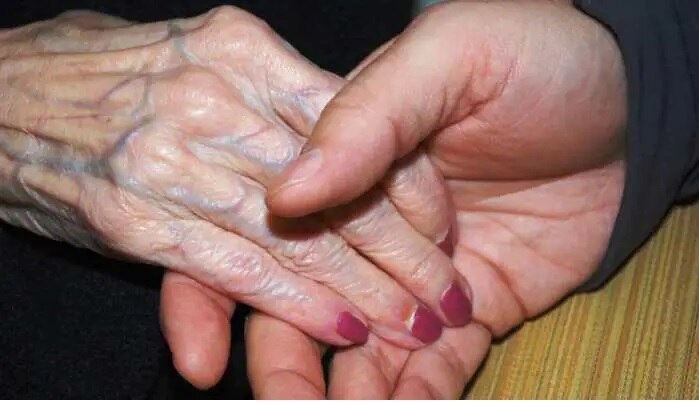 Health precautions and care, skin colour changes means you might facing ...