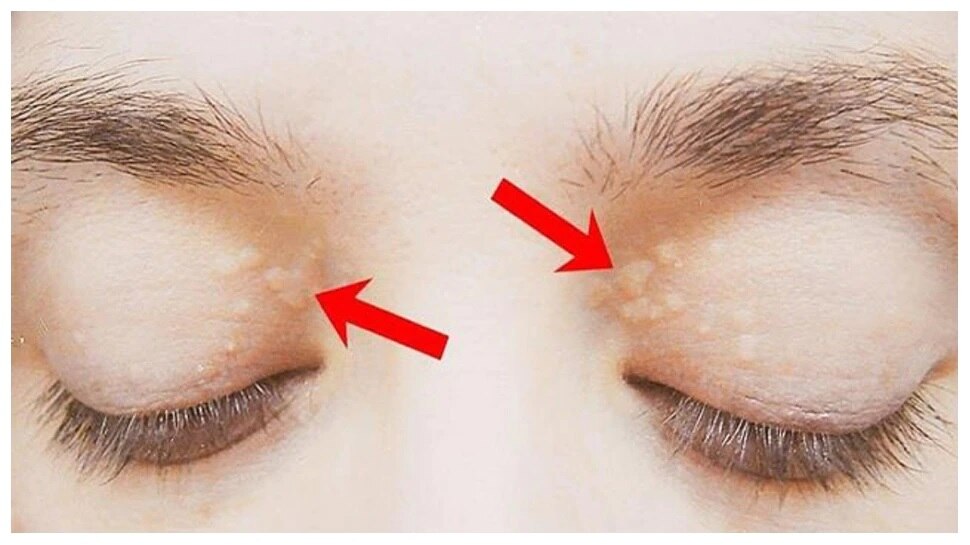 Health tips and precautions, if you find some spots and pain on the ...