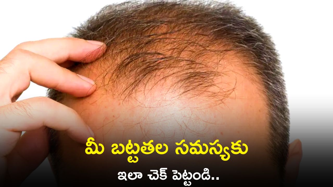 Hair Fall Desi Remedies: Onion Juice Can Reduce Hair Fall In 5 Days ...