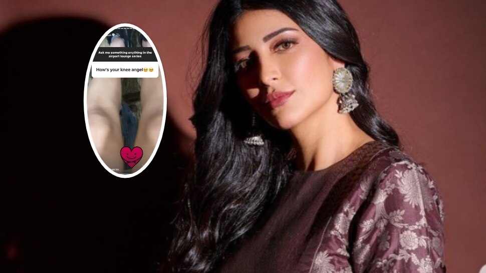 Shruti Haasan Funny Reply to Netizen who Asked on Her Knee injury Angle ... Shruti Haasan Funny Reply to Netizen who Asked on Her Knee injury Angle ...