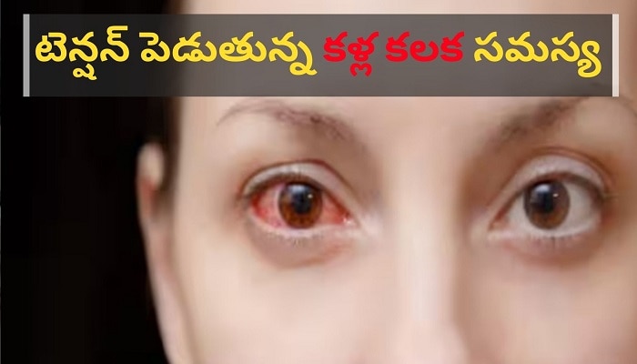 Conjunctivitis cases in hyderabad, Eye Flu Cases In India, how To Keep Yourself and your Kids ...