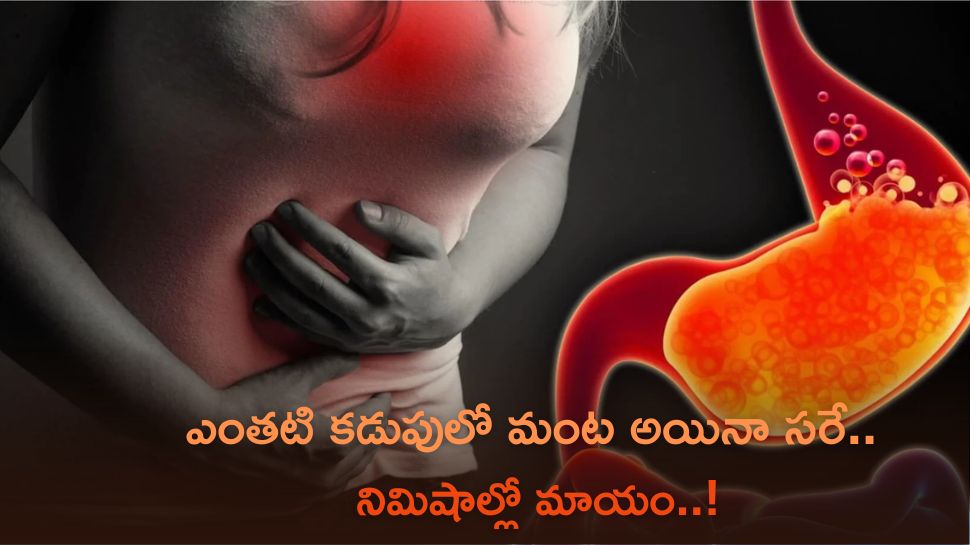 Get Relief From Acidity By Using Homemade Remedies Which Everyone Must ...