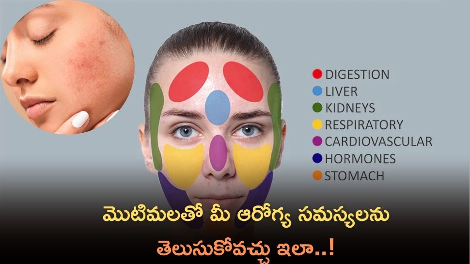 Pimples On Our Face Can Identify The Health Problems And Helps To Get ...