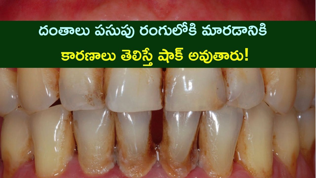 Teeth Discoloration Problems Occur Due To Vitamin B12 Deficiency ...