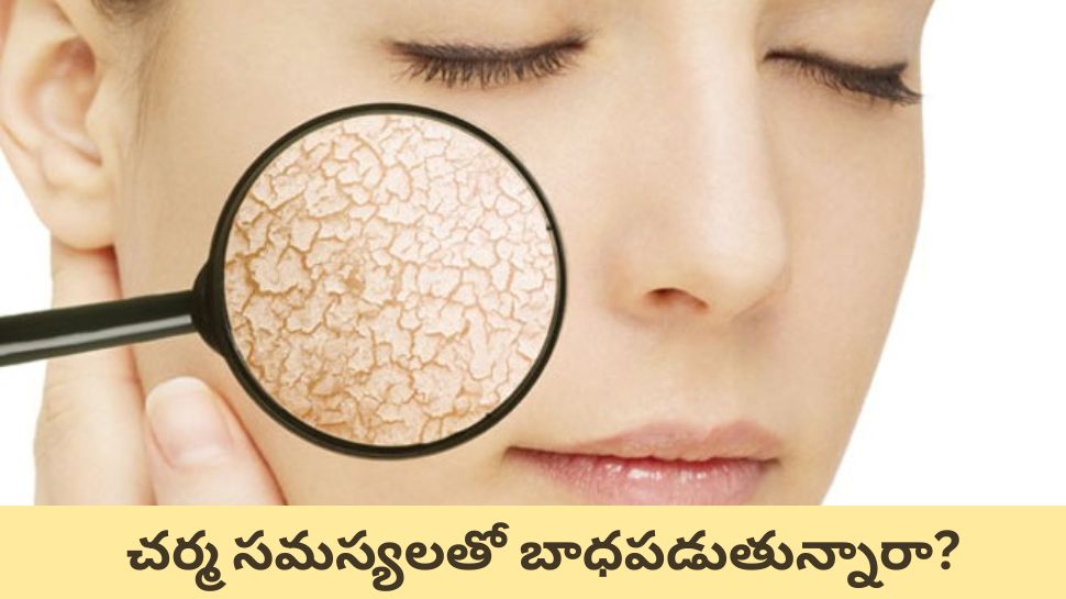 Facing Dull And Dry Skin Problems These Vitamin Deficiencies May Be The ...