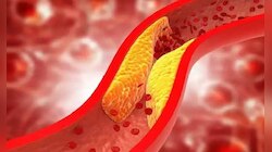 How Cinnamon powder helps to reduce cholesterol News in Telugu, Latest ...