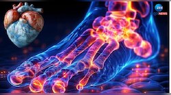 Cholesterol Blockage Reasons News in Telugu, Latest Cholesterol ...