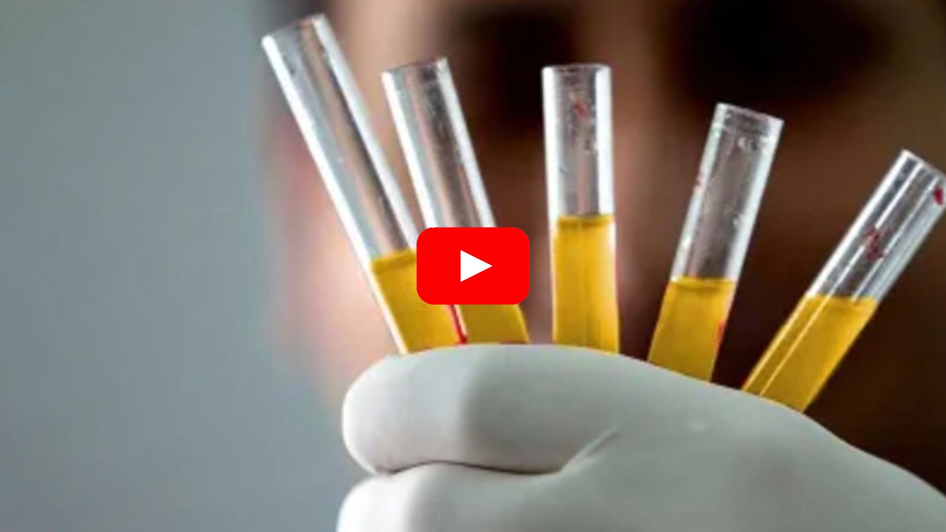 Rare Golden Blood Group Video | Golden Blood Group Video: ప్రపంచంలో 43 ...