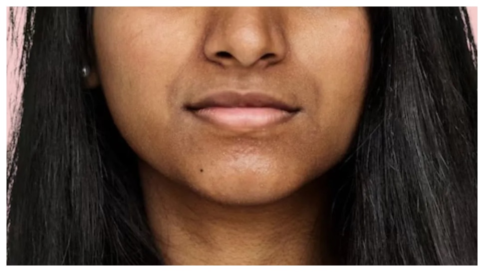 How to Remove Darkness Around Mouth Fast Home Remedies for Dark Skin ...