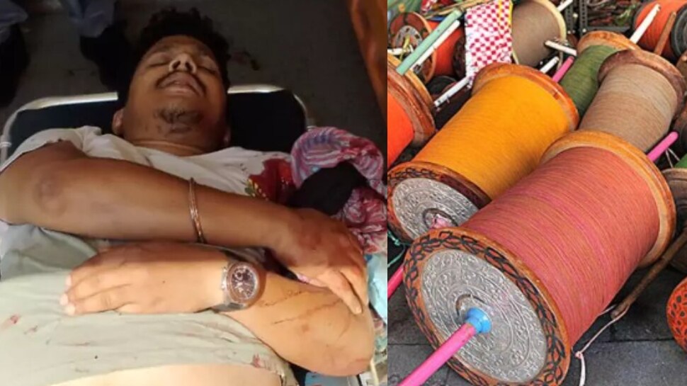 Software engineer seriously injured after China manja slits his hand in ...