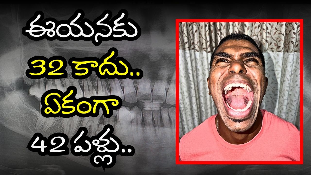 Malaysian Man Sets Guinness World Record with 42 Teeth | వావ్.. ఈయనకు ...