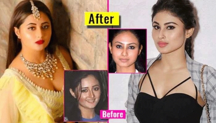 Photos: అందాన్ని పెంచుకోవడానికి ప్లాస్టిక్ సర్జరీ చేయించుకున్న తారలు ...