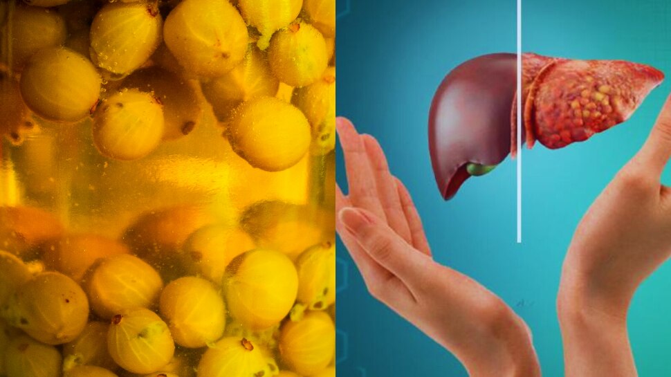 Fatty Liver Cure Naturally Eat Amla Daily for Liver Detox And Health ...