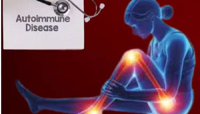 Health tips and precautions of autoimmune disease why this disorder ...